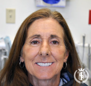 Twenty-One, Transformed Smiles from 2021 - New Teeth Now