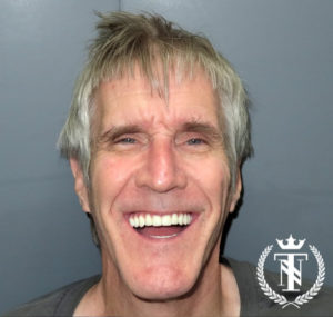 Twenty-One, Transformed Smiles from 2021 - New Teeth Now