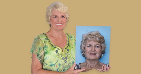 New Teeth Now | Dental Implant Center | Florida & California