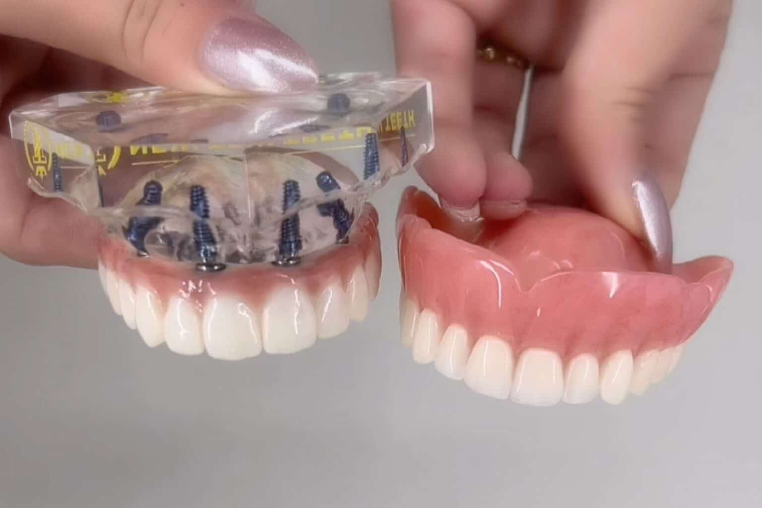 The Highest-Quality Alternative to Dentures - New Teeth Now