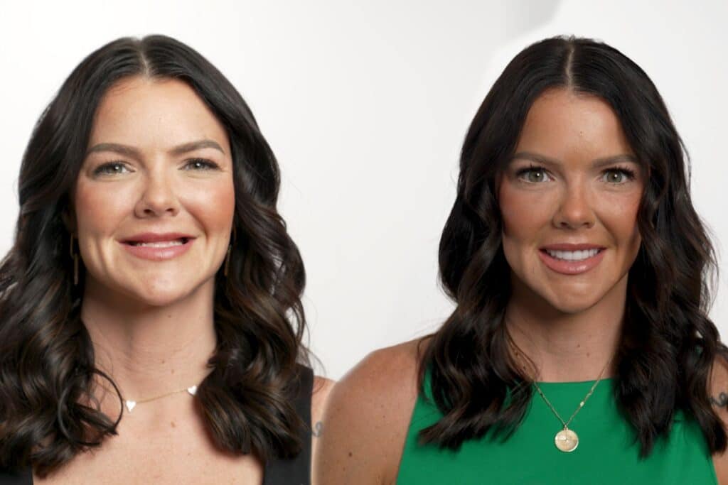 Snap-On Dentures vs. Permanent Implants: What’s the Difference? - New ...